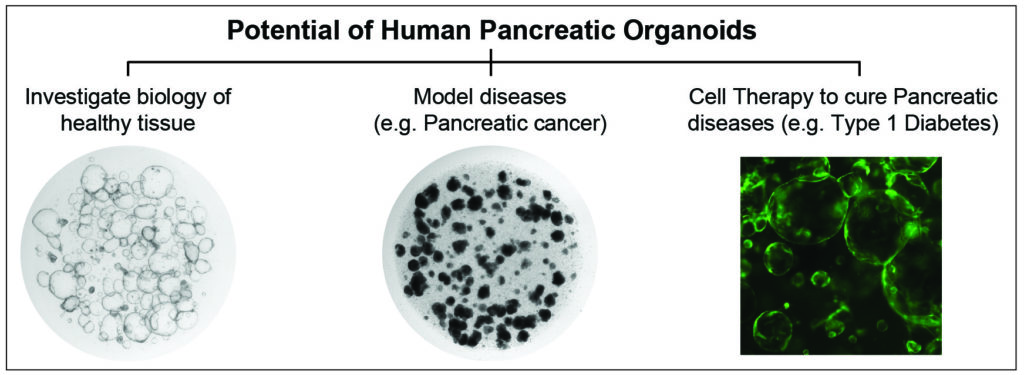 BMC Series blog Human Pancreas Organoids: A step closer to ...