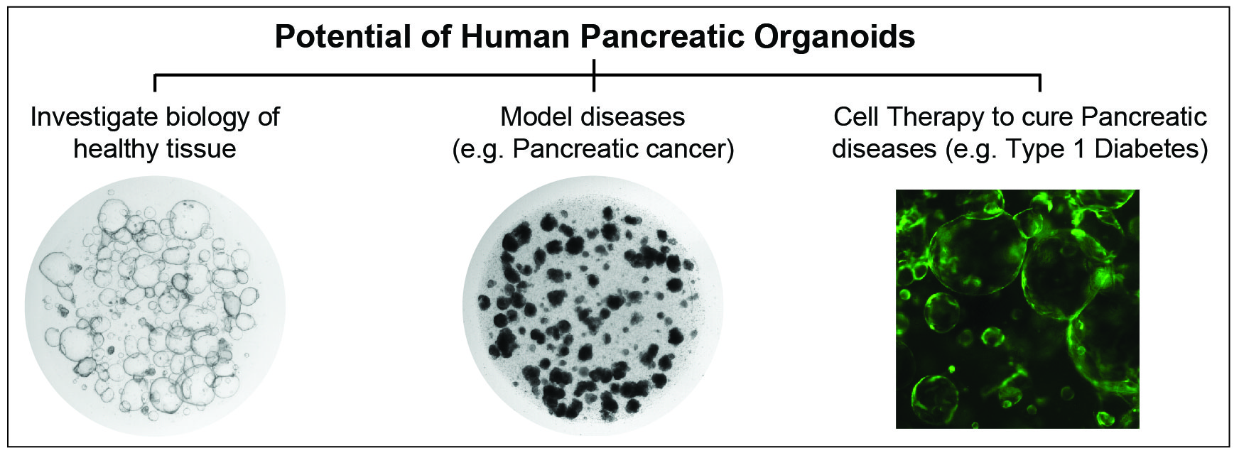 BMC Series blog Human Pancreas Organoids: A step closer to ...