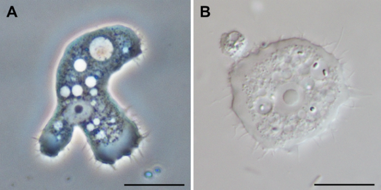 BugBitten Rare, forgotten but dangerous: Pathogenic free-living amoebas ...