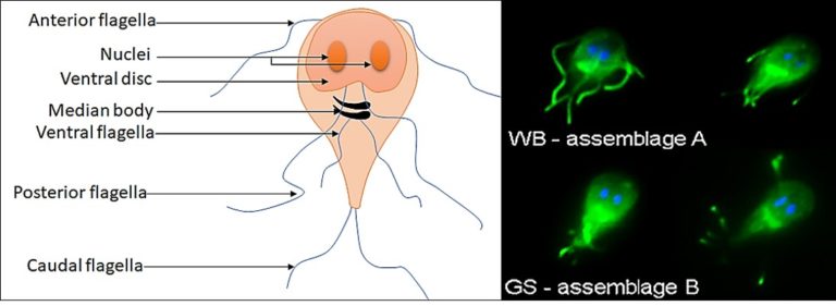 BugBitten Giardiasis from Proteomics to Pathogenesis