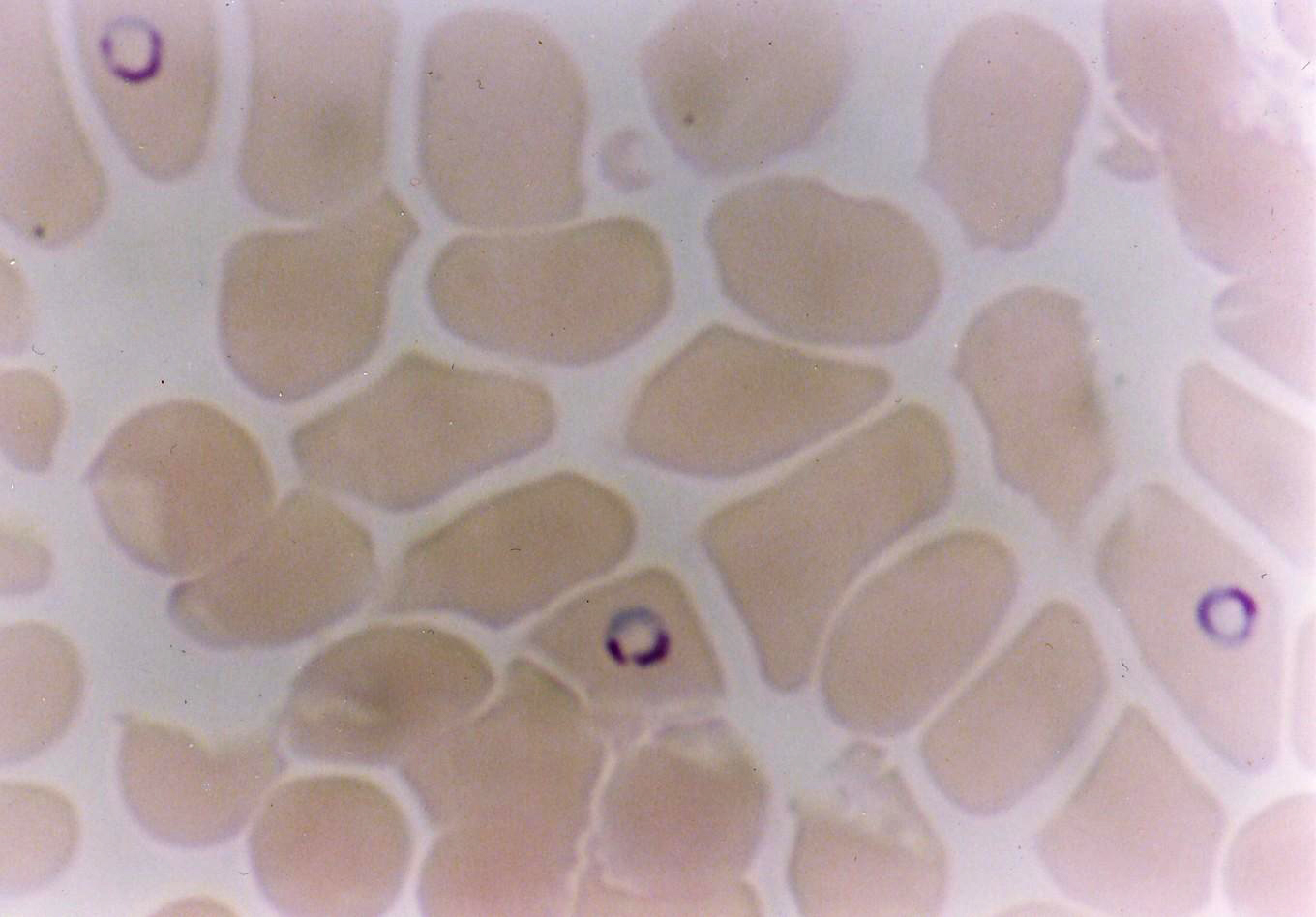 BugBitten A promising new malaria vaccine candidate