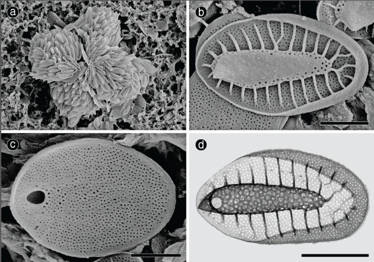 On Biology Images of the newly recorded species of the genus Synura ...