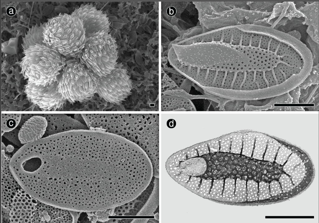 On Biology Images of the newly recorded species of the genus Synura ...