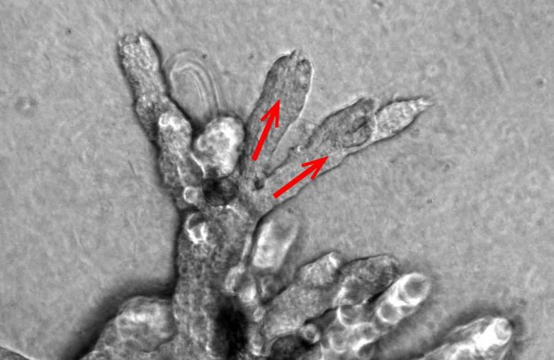 Building breast tissue to help understand breast cancer - On Medicine