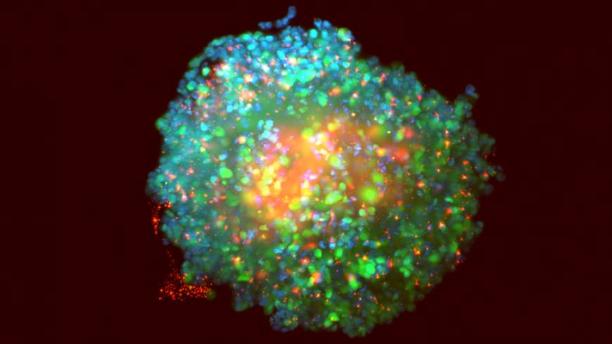 Breast Cancer Research Image Competition 2017 - On Medicine